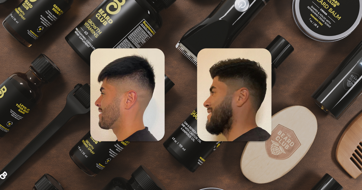 This Brand Is So Confident They Can Help You Grow a Beard That They'll ...